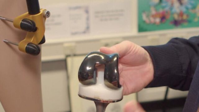 Herstel kraakbeen als succesvol alternatief voor knieprothese | NPO Radio 1